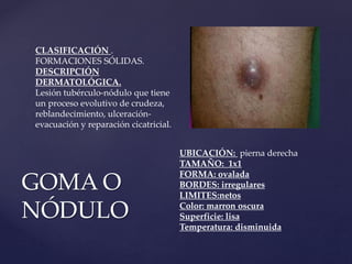 LESION ELEMENTAL pptx | PPTX