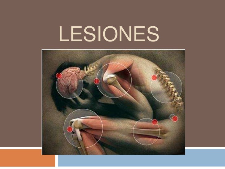 Lesiones