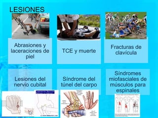 Lesiones | PPTX