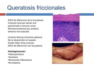 LESIONES BENIGNAS, CANCERÍGENAS Y NEOPLASIAS MALIGNAS DE ORIGEN ...