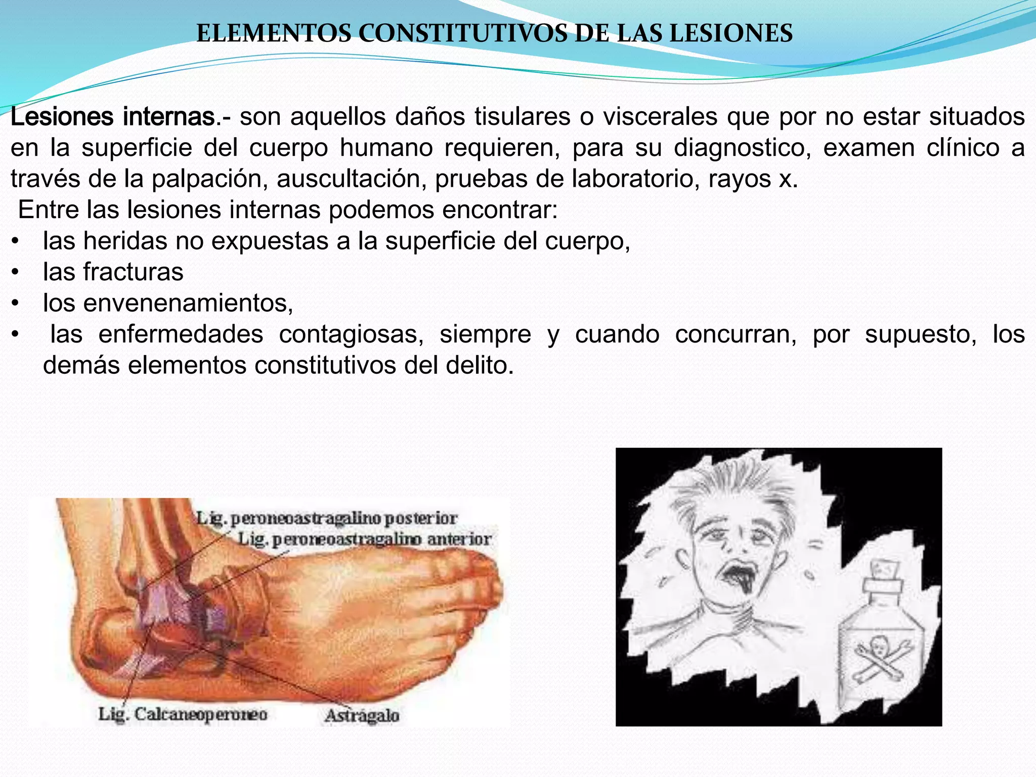 Delito De Lesiones Pptx