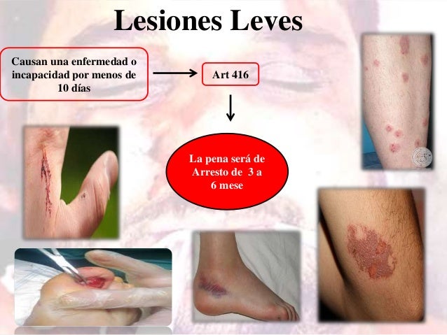 Lesiones