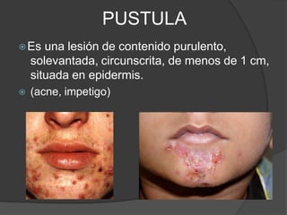 LESIONES.pptx