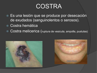 LESIONES.pptx