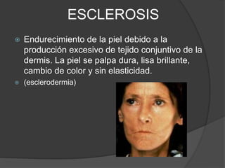 LESIONES.pptx