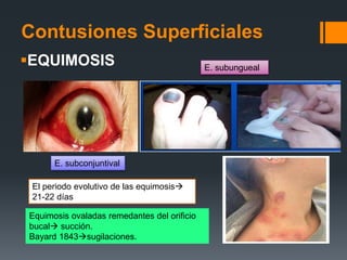 Equimosis Bucal