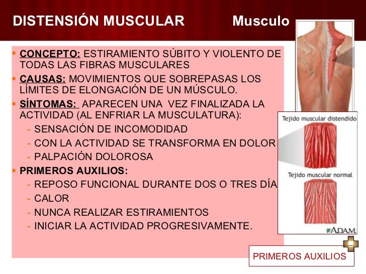 Contracturas Articulares