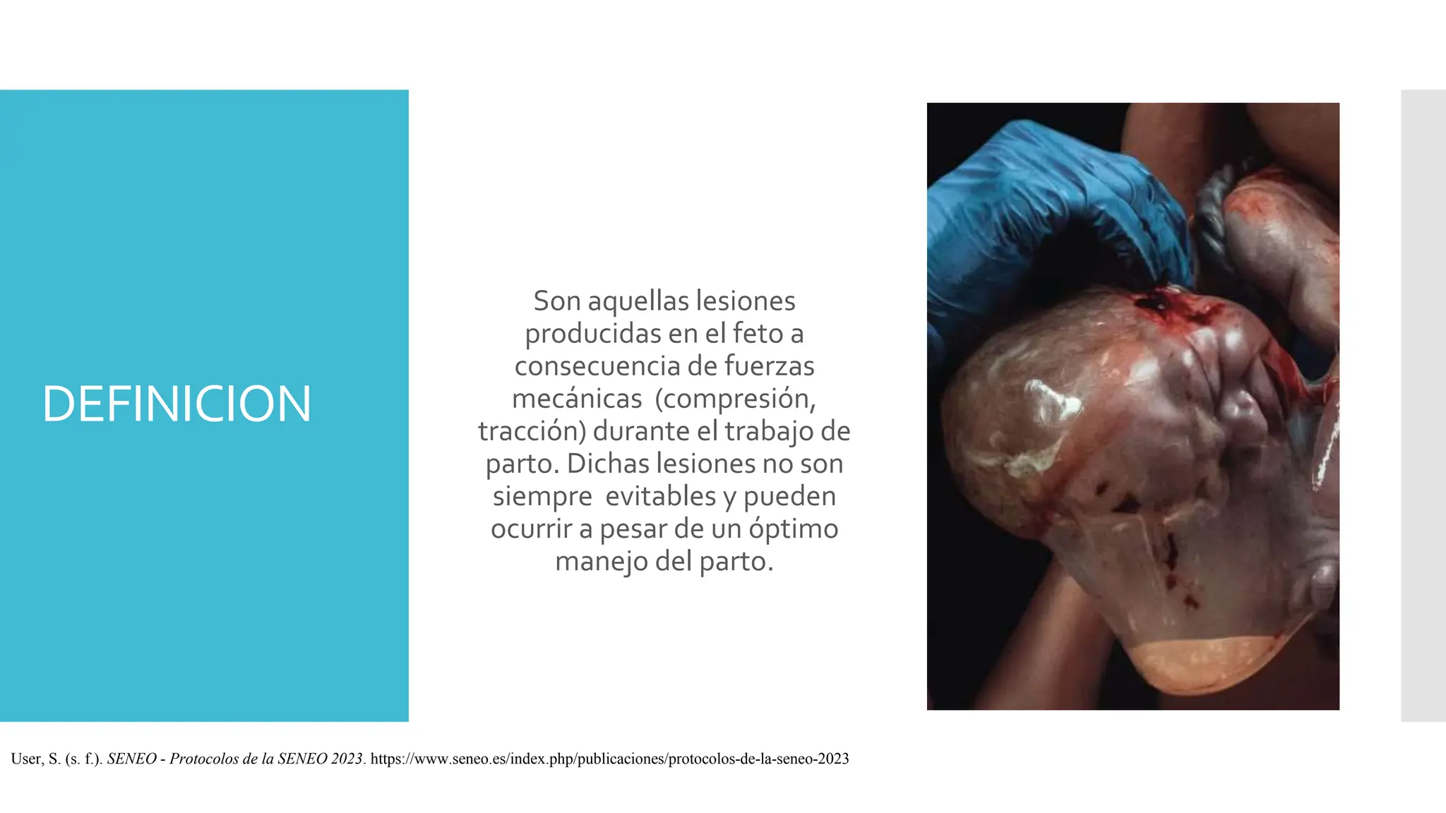 LESIONES ASOCIADAS ALA VIA DEL NACIMIENTO.pptx