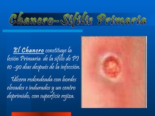 Lesiones benignas de vagina y vulva | PPT