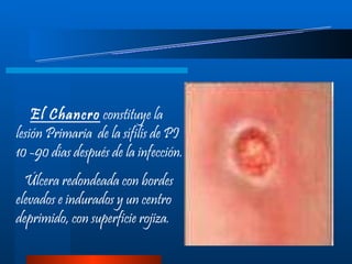 Lesiones benignas de vagina y vulva | PPT