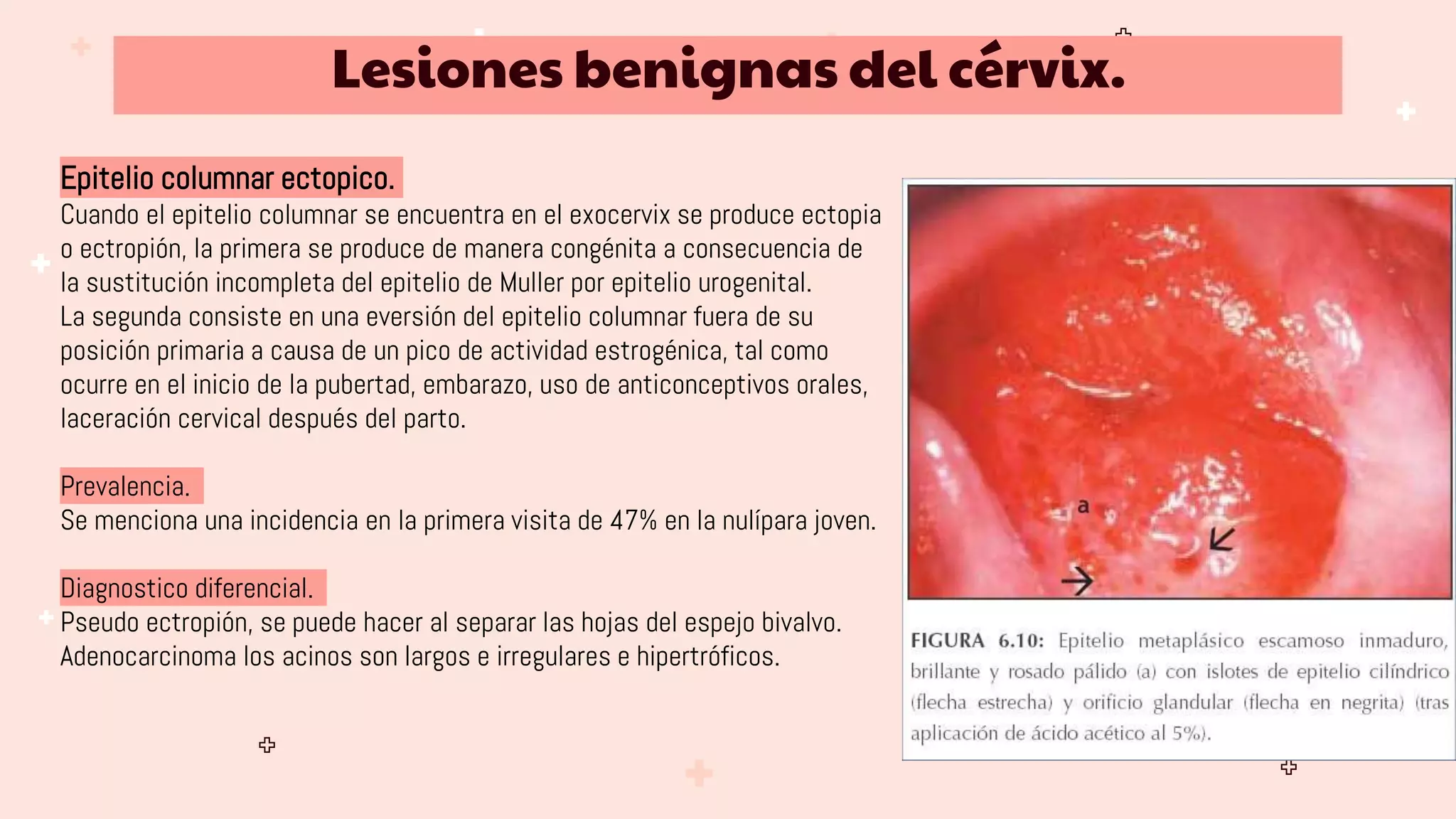 Lesiones beningas del cérvix e hiperplasia de endometrio. | PPTX
