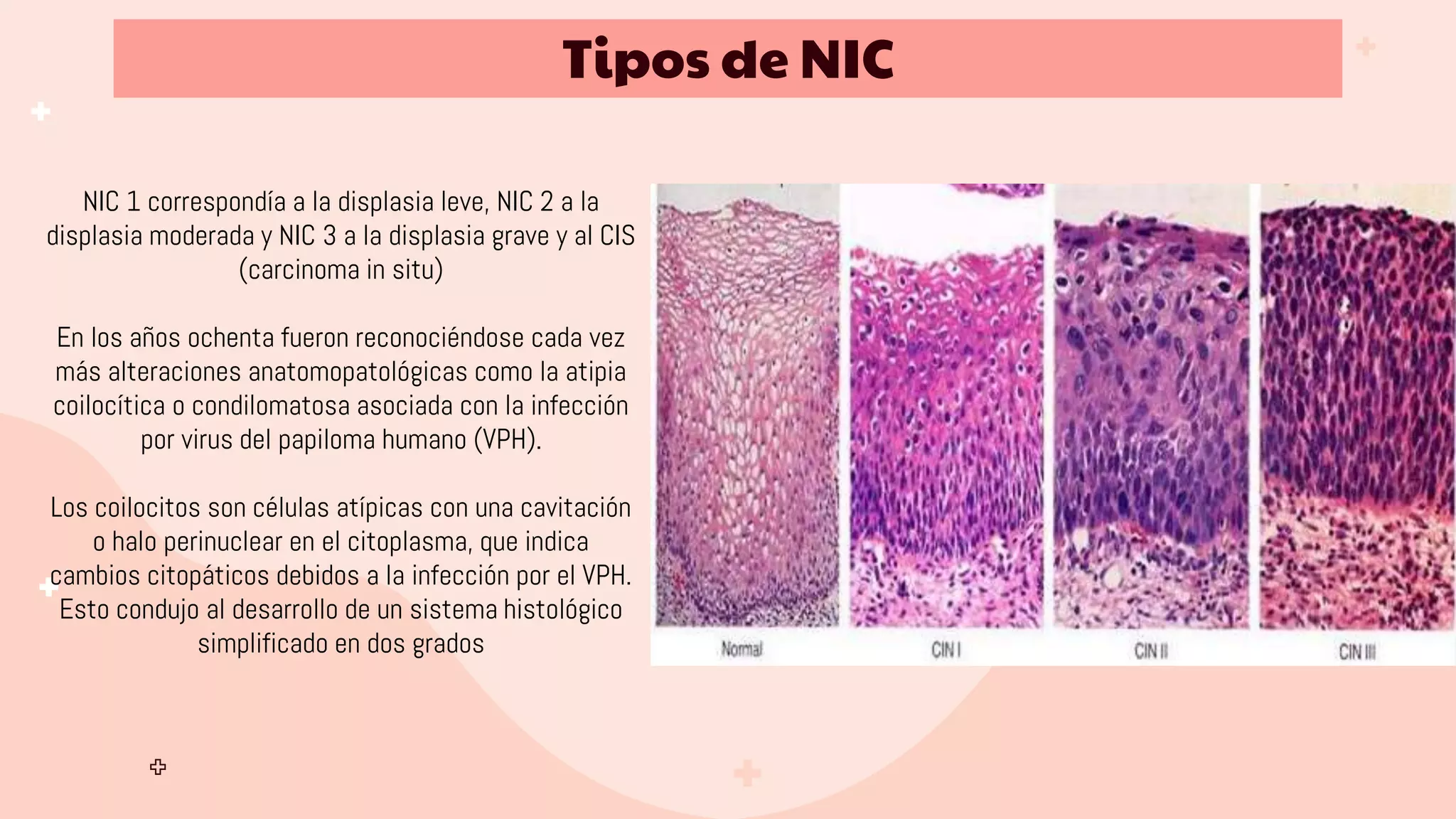 Lesiones beningas del cérvix e hiperplasia de endometrio. | PPTX