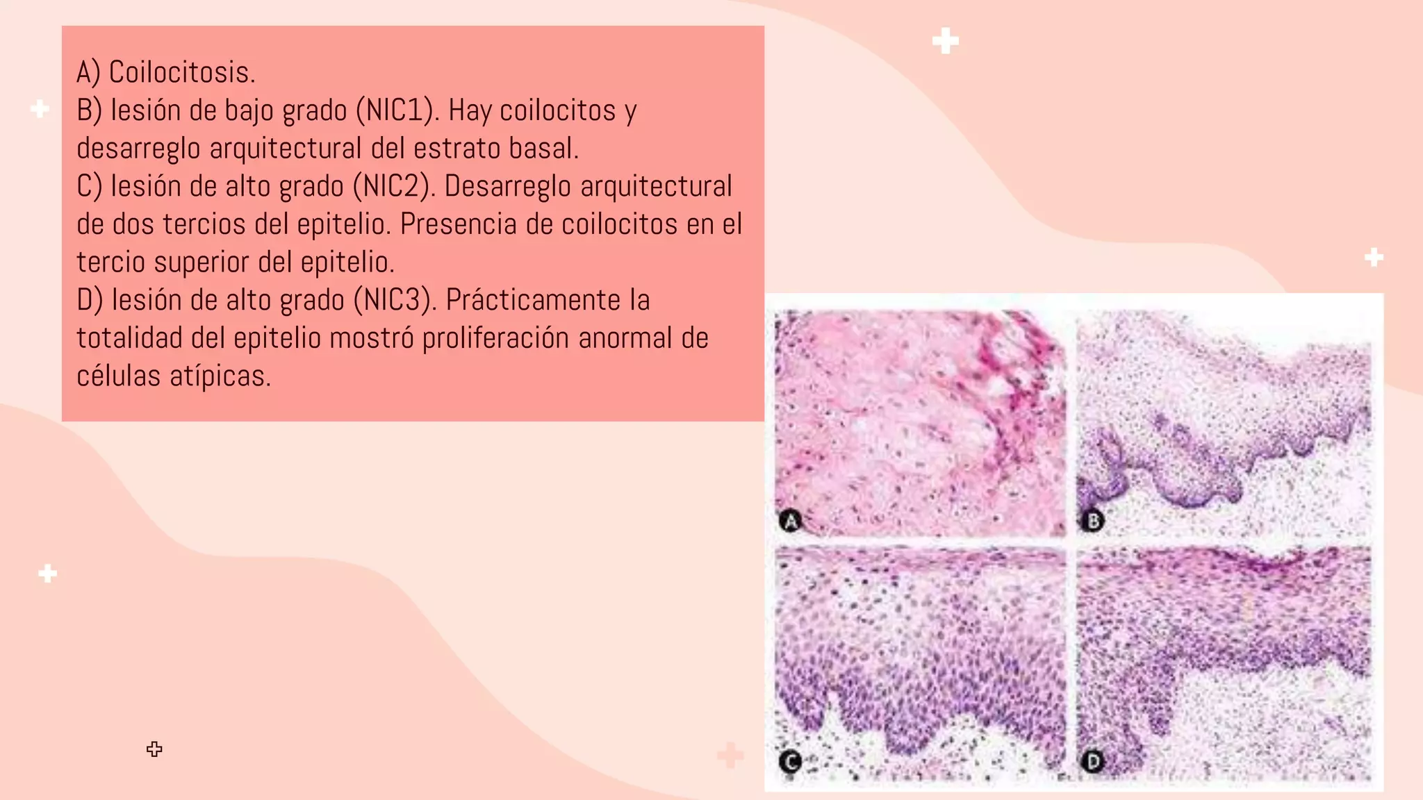 Lesiones beningas del cérvix e hiperplasia de endometrio. | PPTX