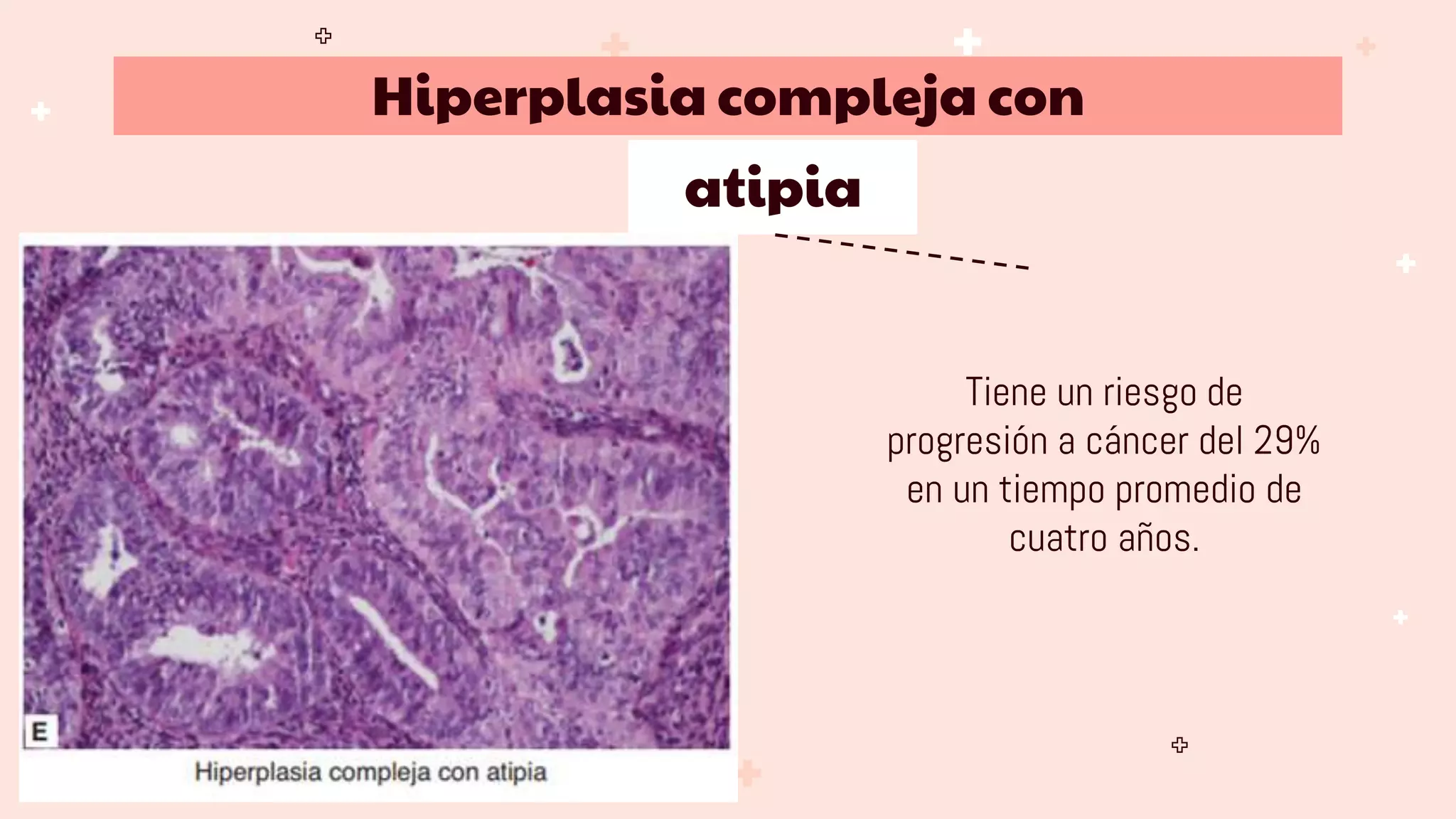 Lesiones beningas del cérvix e hiperplasia de endometrio. | PPTX