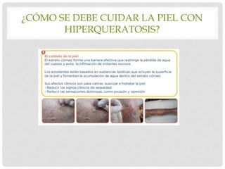LESIONES CON HIPERQUERATOSIS cuadro clinico | PPTX