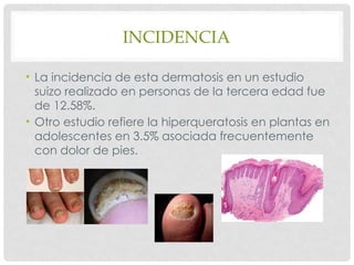 LESIONES CON HIPERQUERATOSIS cuadro clinico | PPTX