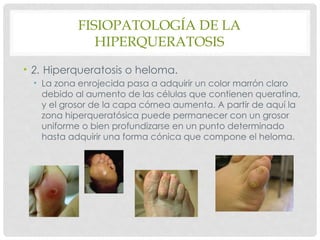 LESIONES CON HIPERQUERATOSIS cuadro clinico | PPTX