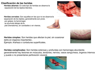Lesiones, contusiones, heridas | PPSX