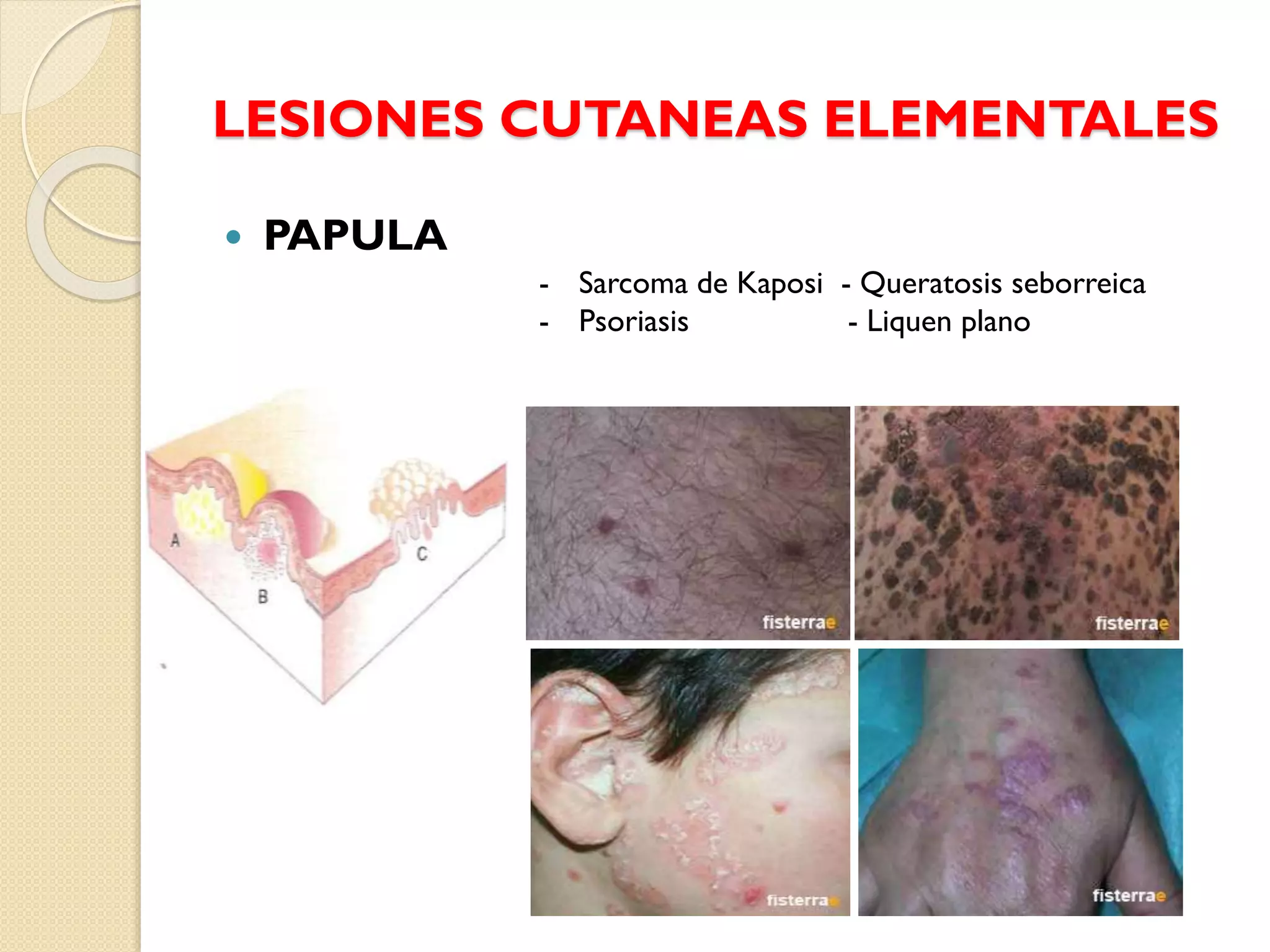 Lesiones cutaneas elementales. dermatologia. efrain negrete | PPTX