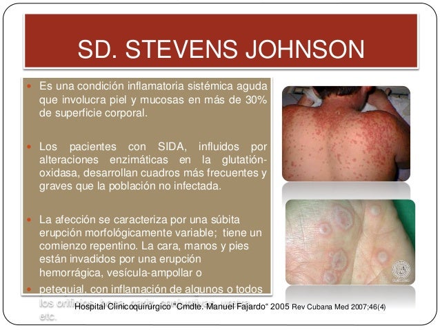 Lesiones cutaneas en pacientes VIH