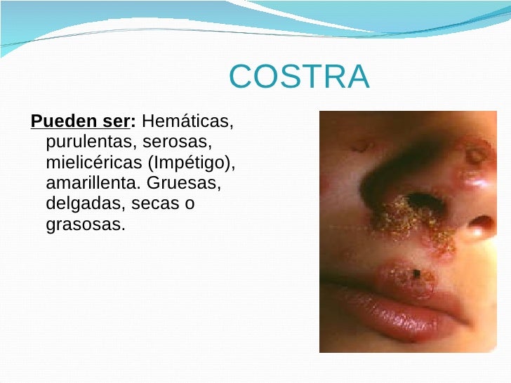 Lesiones Cutaneas Fundamentales Yelementosdiagnosticos