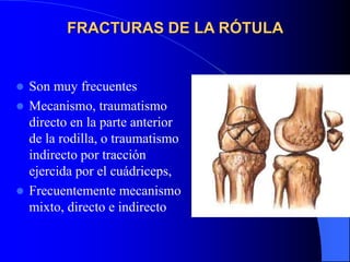 Lesiones de Fémur y Rodilla - Traumatología | PDF