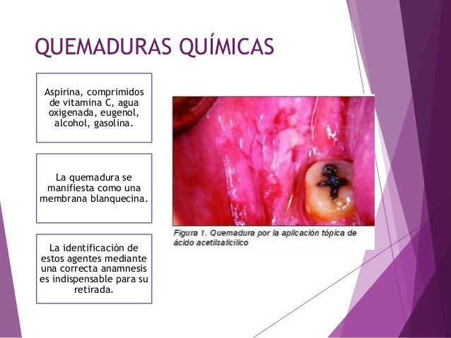 Lesiones de la mucosa oral