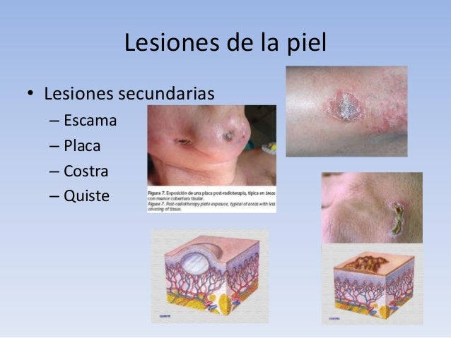 Lesiones de la piel
