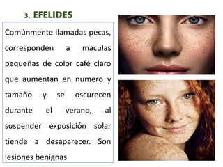 Lesiones de la piel | PDF