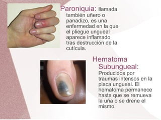 Lesiones de la piel raysa | PPT