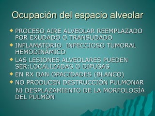 Lesiones del espacio aereo - Diagnostico por imagen | PPT