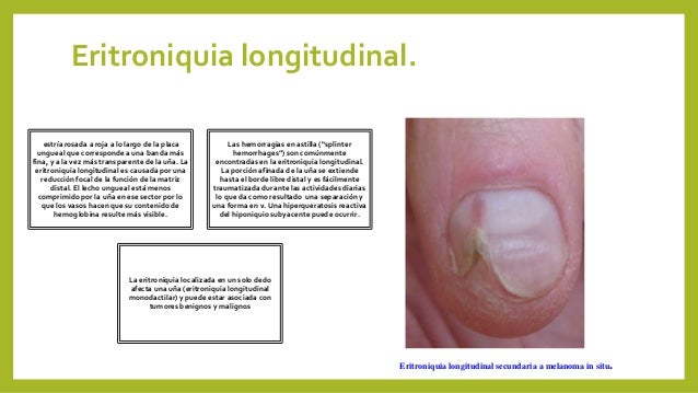 Lesiones del lecho ungueal