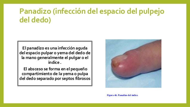 Lesiones del lecho ungueal