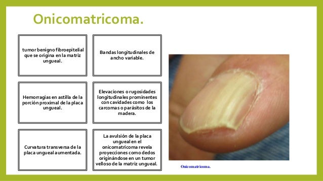 Lesiones del lecho ungueal