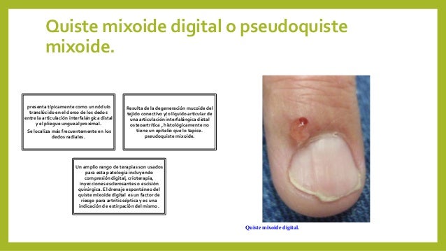 Lesiones del lecho ungueal