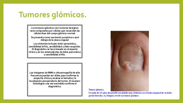 Lesiones del lecho ungueal