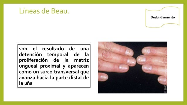 Lesiones del lecho ungueal