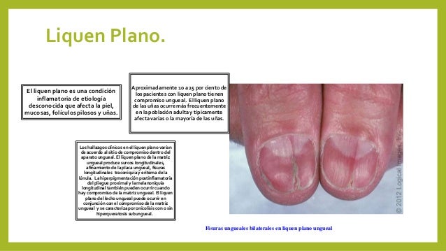 Lesiones del lecho ungueal