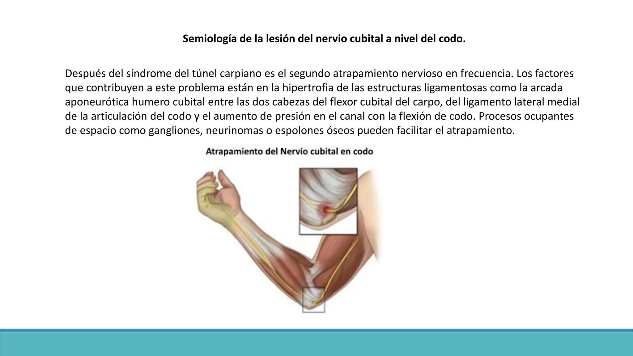 Lesiones del nervio cubital anatomia.pptx