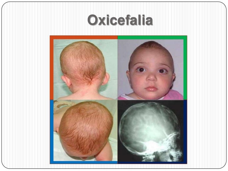 Lesiones de los huesos del craneo