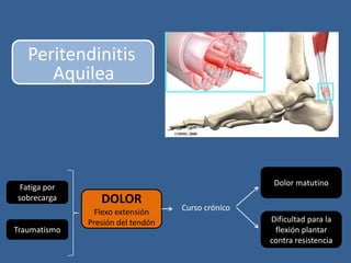 Lesiones del tendón | PPTX
