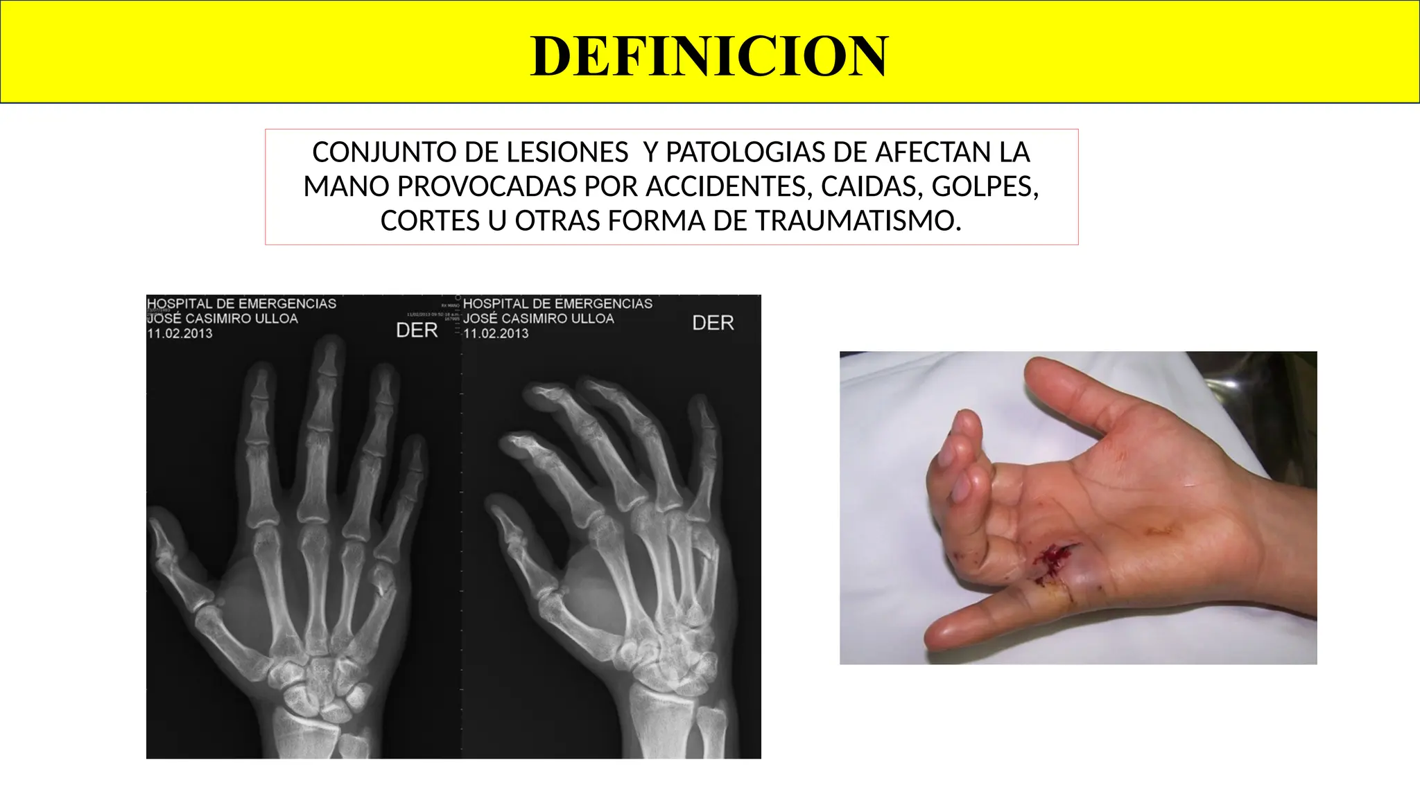 LESIONES DE MANO TRAUMATOLOGIa y ortopediapptx | PPT