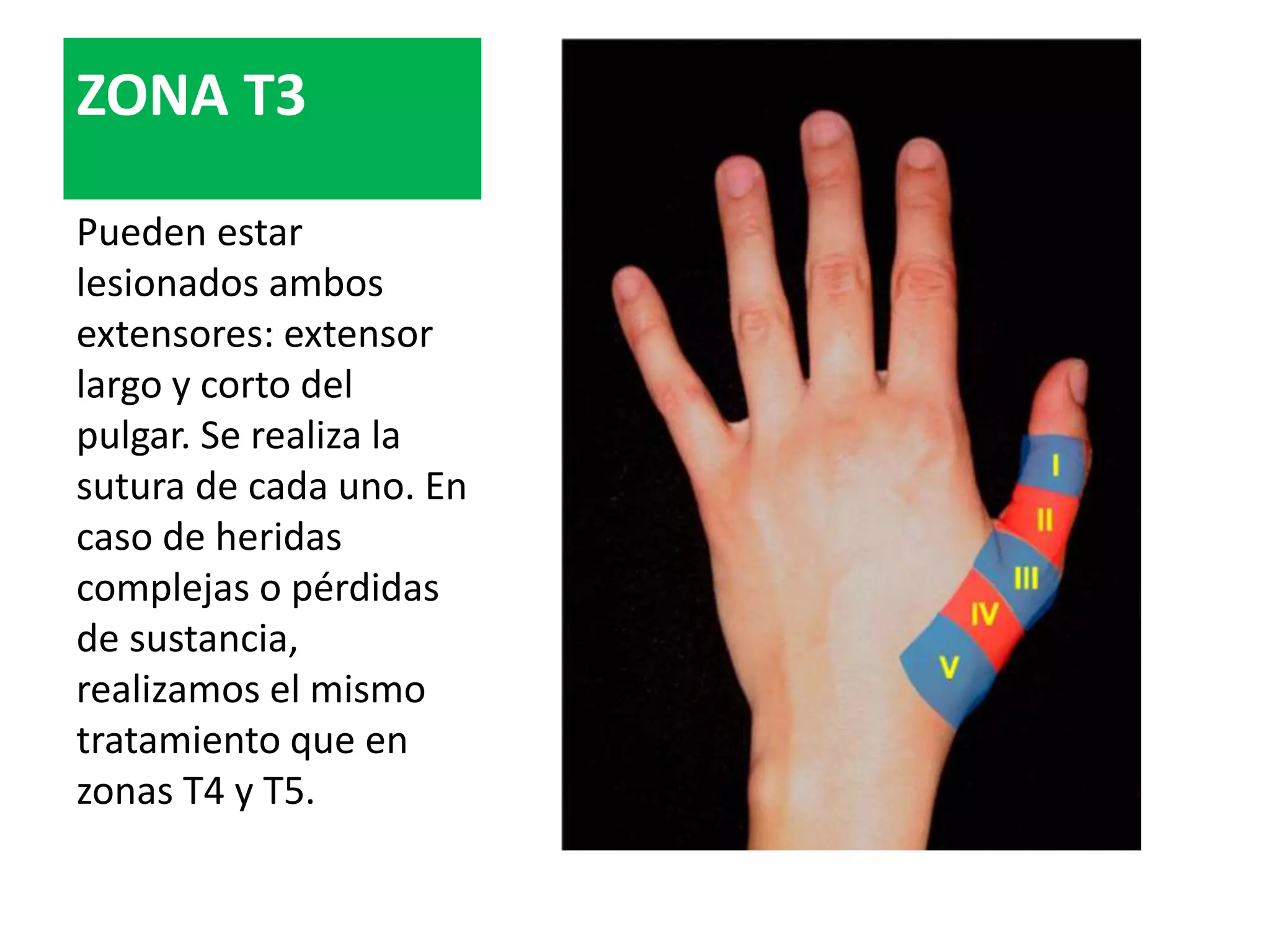 LESIONES DE PARTES BLANDAS DE LA MANO.pptx