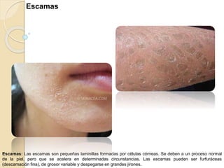 Lesiones de piel (primarias y secundarias) | PPTX