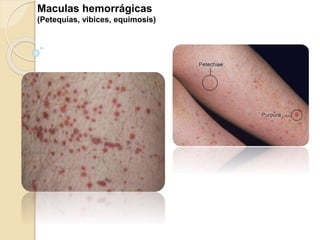 Lesiones de piel (primarias y secundarias) | PPTX