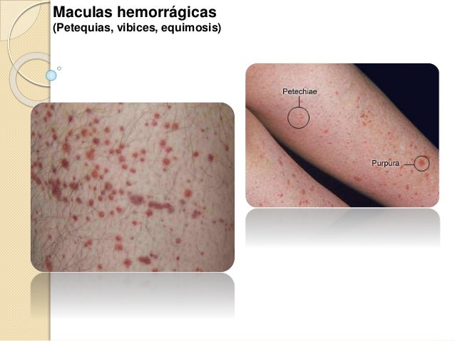 Lesiones de piel (primarias y secundarias)