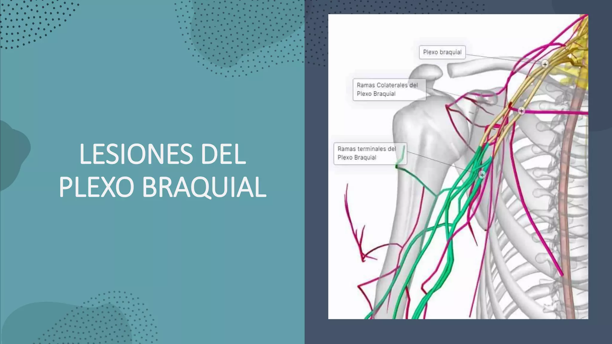 LESIONES DE PLEXO BRAQUIAL.pptx