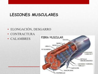 Lesiones deportivas | PPTX