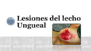 Lesiones de Pulpejo | PPTX