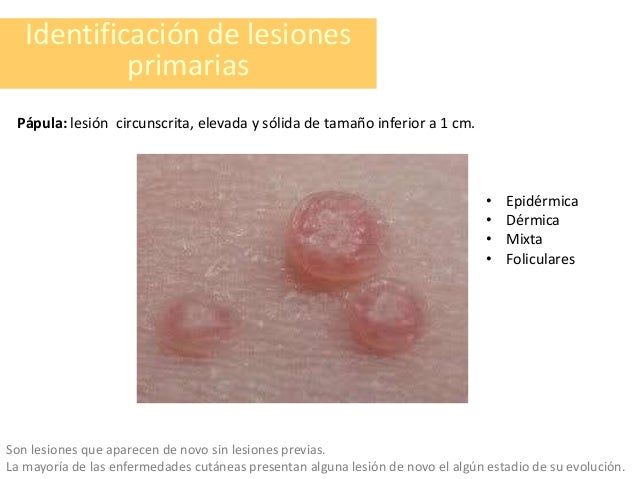 Lesiones dermatológicas